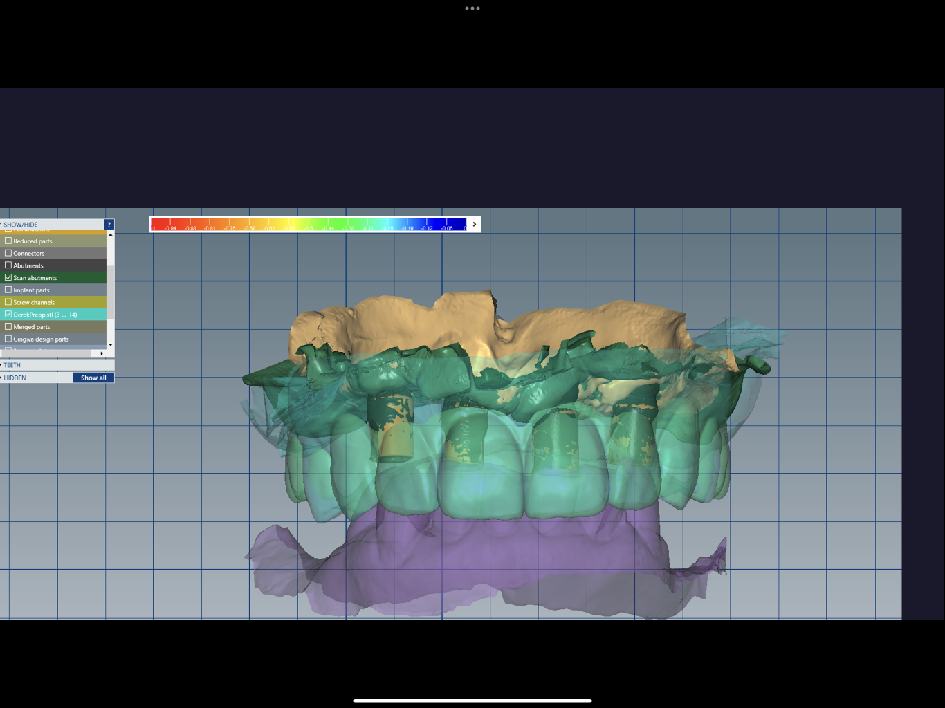 Dental Innovation and Excellence | Spectrum Dental Science Inc