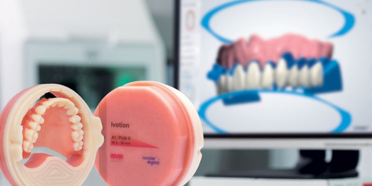 Ivotion Denture System - Spectrum Dental Science
